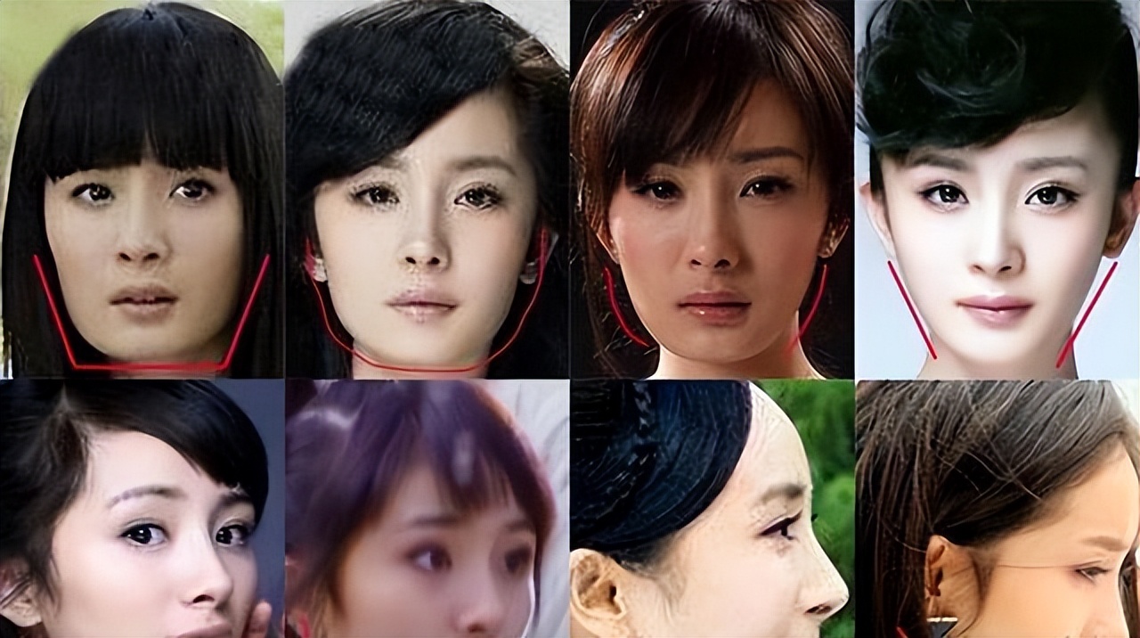 Has the one-size-fits-all "facelift" changed? The sequelae come out ...