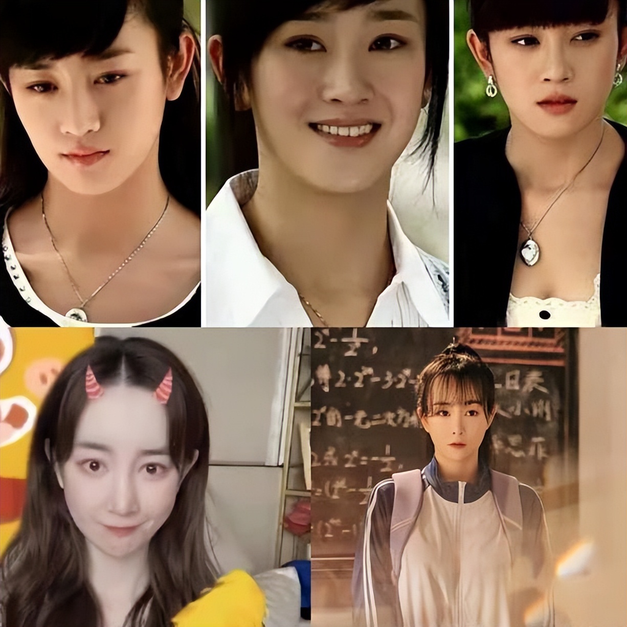 The contrast between female stars before and after plastic surgery is ...
