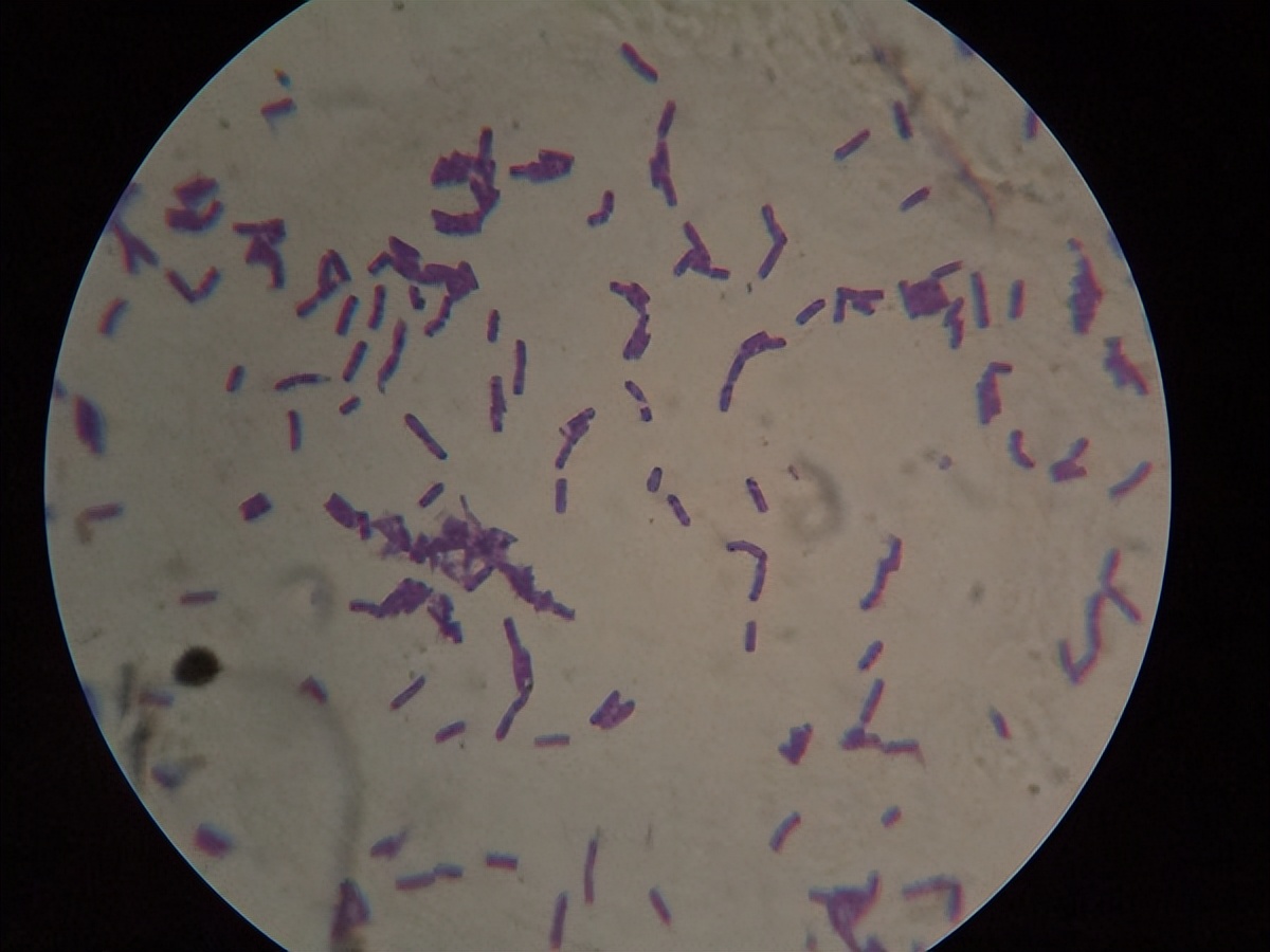 Association of bifidobacteria with human disease and variable ...