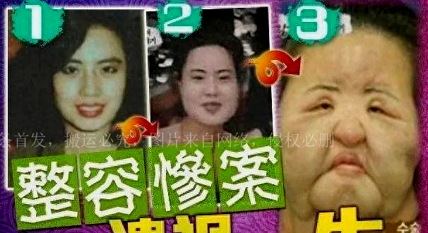 The 28-year-old female singer is addicted to plastic surgery and lacks ...