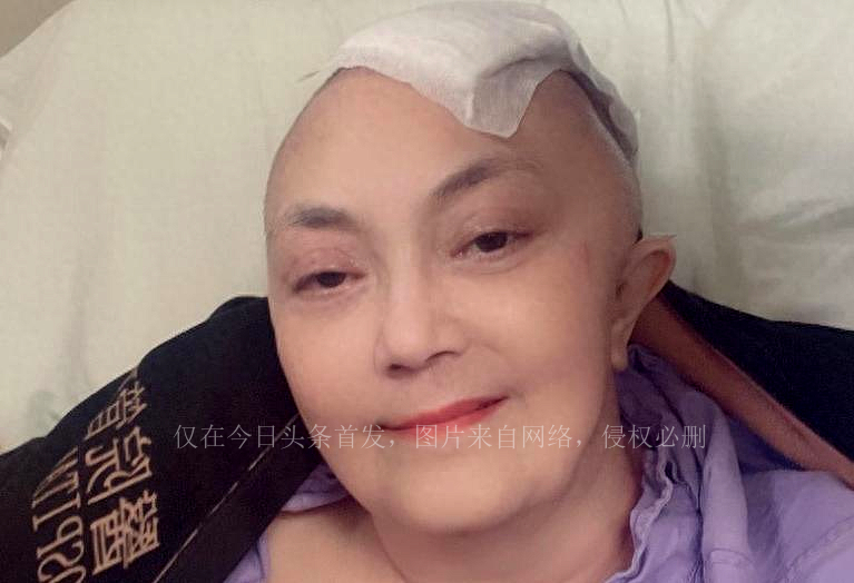 Veteran actor Shi Ming was in a severe coma and appeared for the first ...