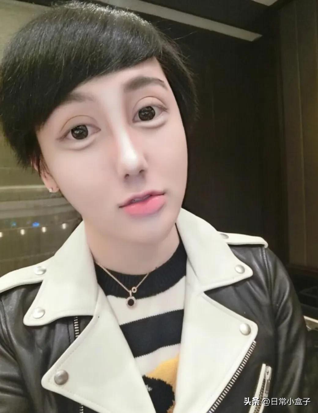 Liu Zichen, who was once known as the king of artificial plastic surgery, has become more and ...