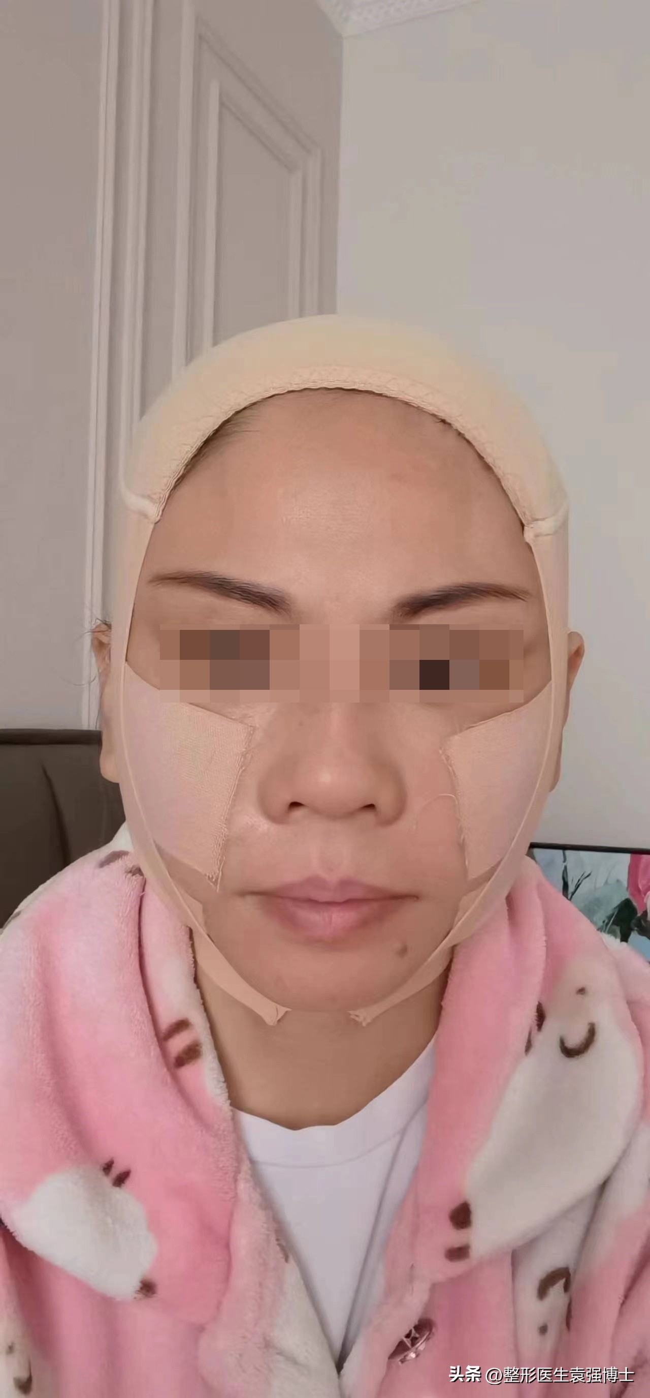 The 46-year-old challenged a full face facelift, almost collapsed ...