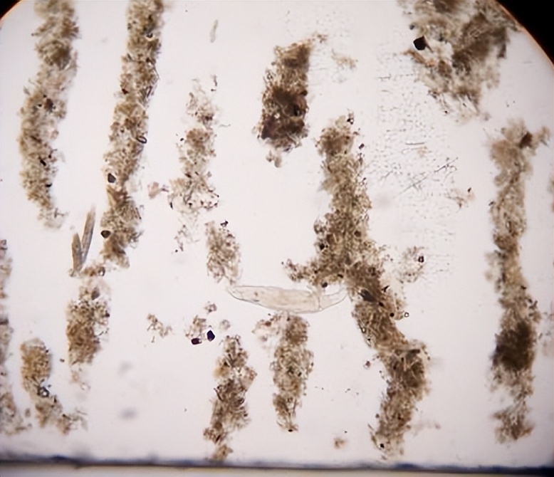 Effects of Anaerobic Sludge Microbes on the Surface Properties of ...