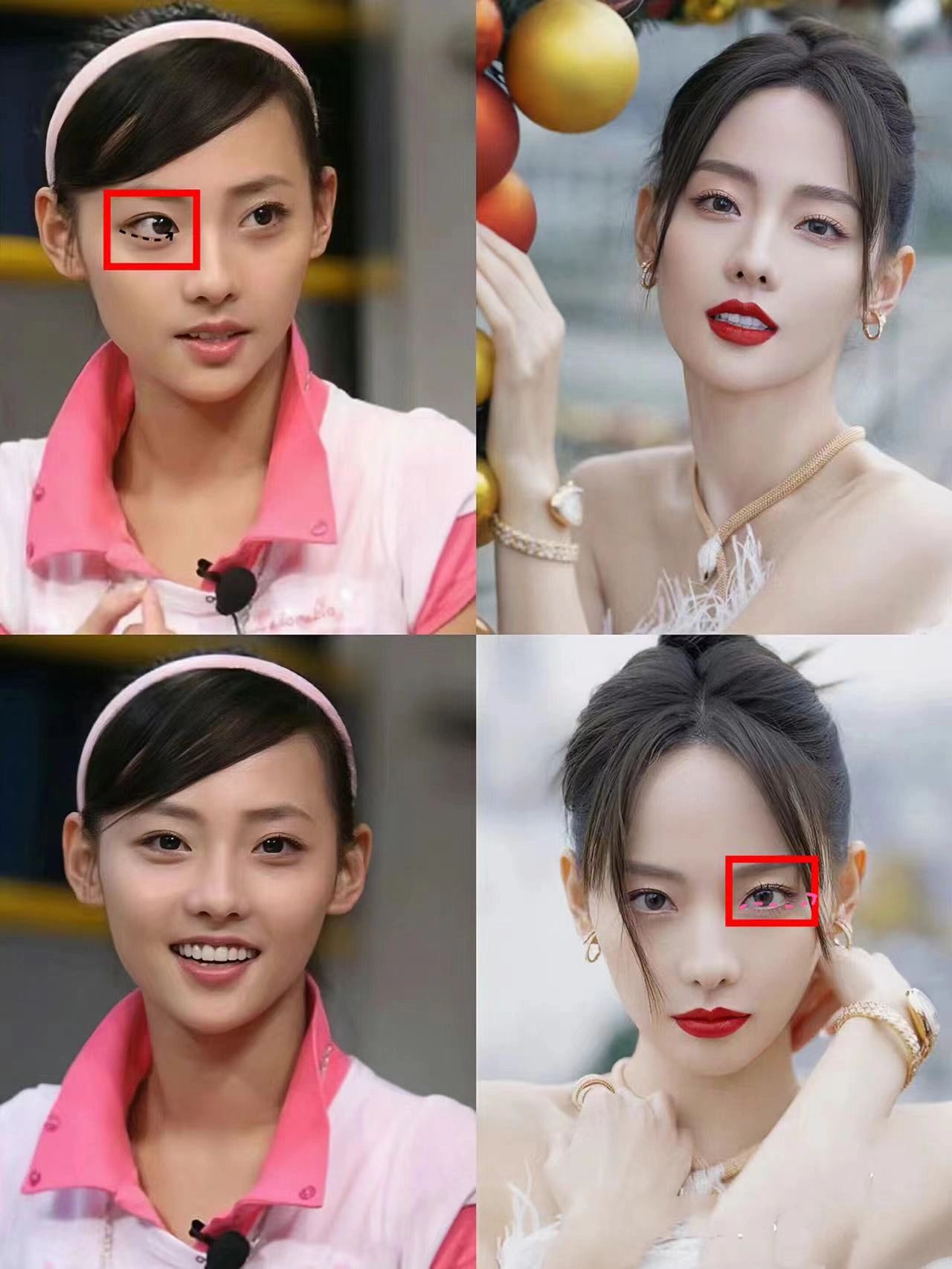 Have you noticed any difference in Zhang Jiani's eyes? - iMedia