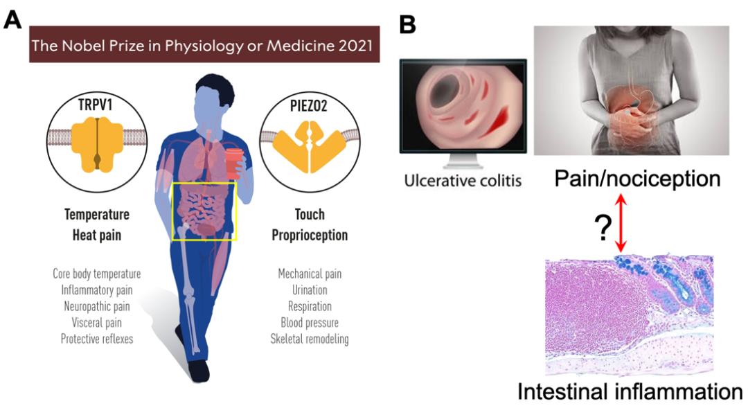 The role of TRPV1+ pain receptors in gut immunity and gut microbial ...