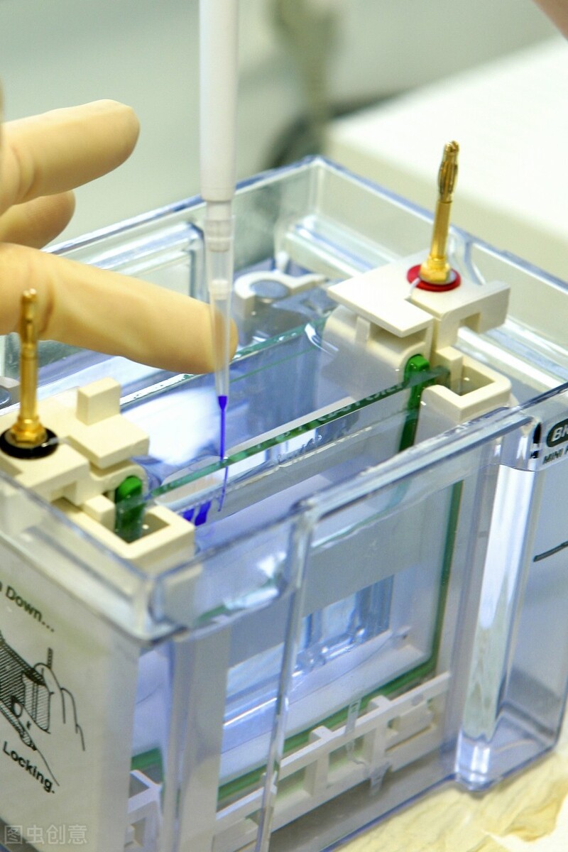 immunofixation electrophoresis - iNEWS