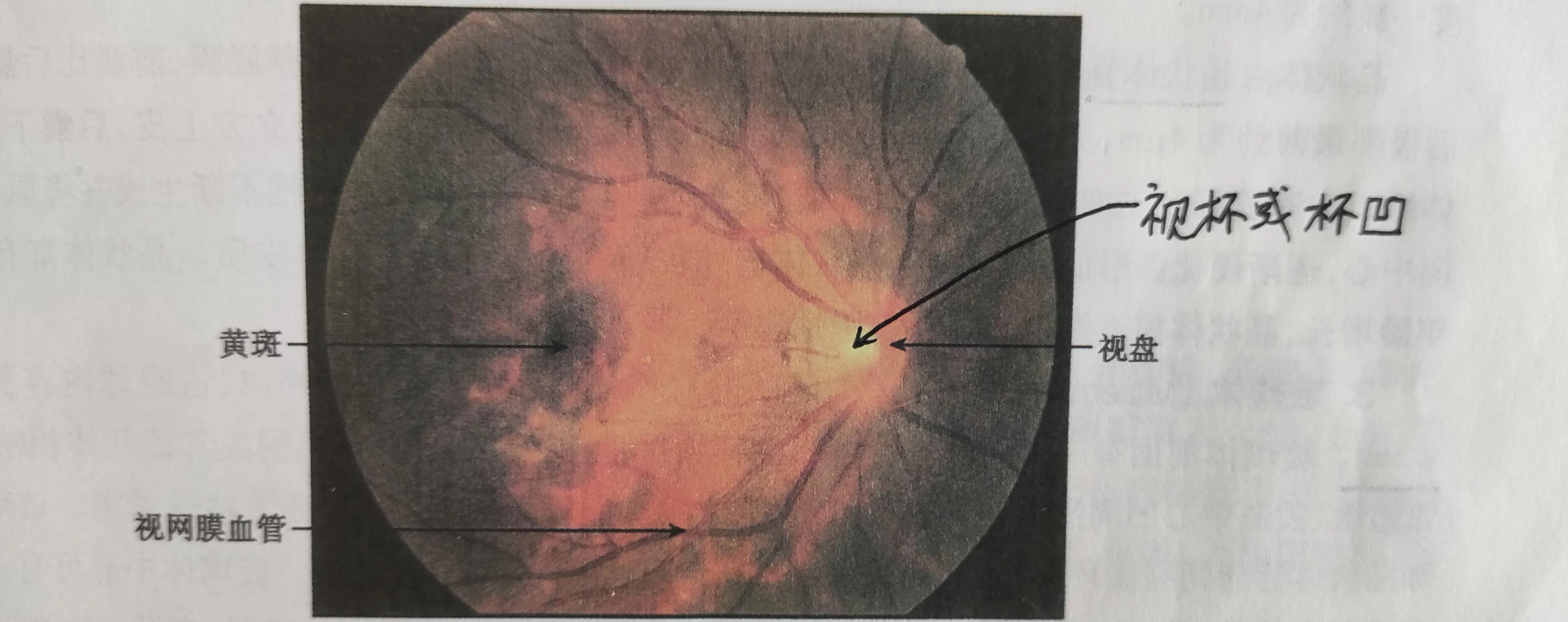 Fundamentals of Ophthalmology - Understanding the Eyeball Wall 3 - iNEWS