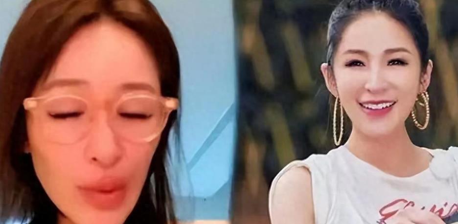 The actress who is addicted to plastic surgery has transformed herself ...