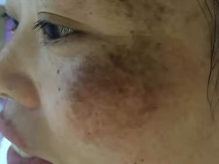 Common types of spots, you have to take the right seat - iNEWS