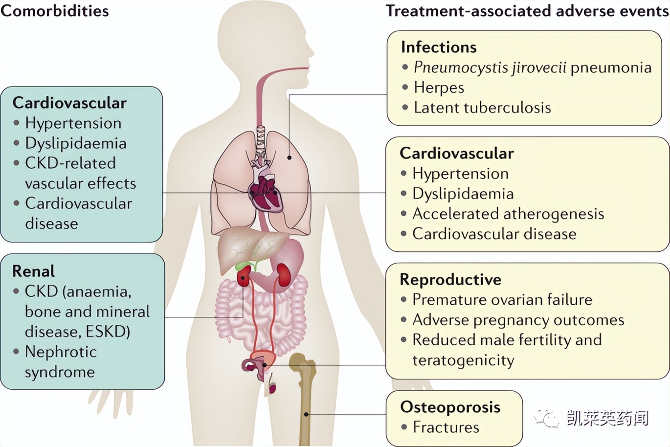 First Oral Lupus Nephritis Drug: EC Approves LUPKYNIS for Lupus ...