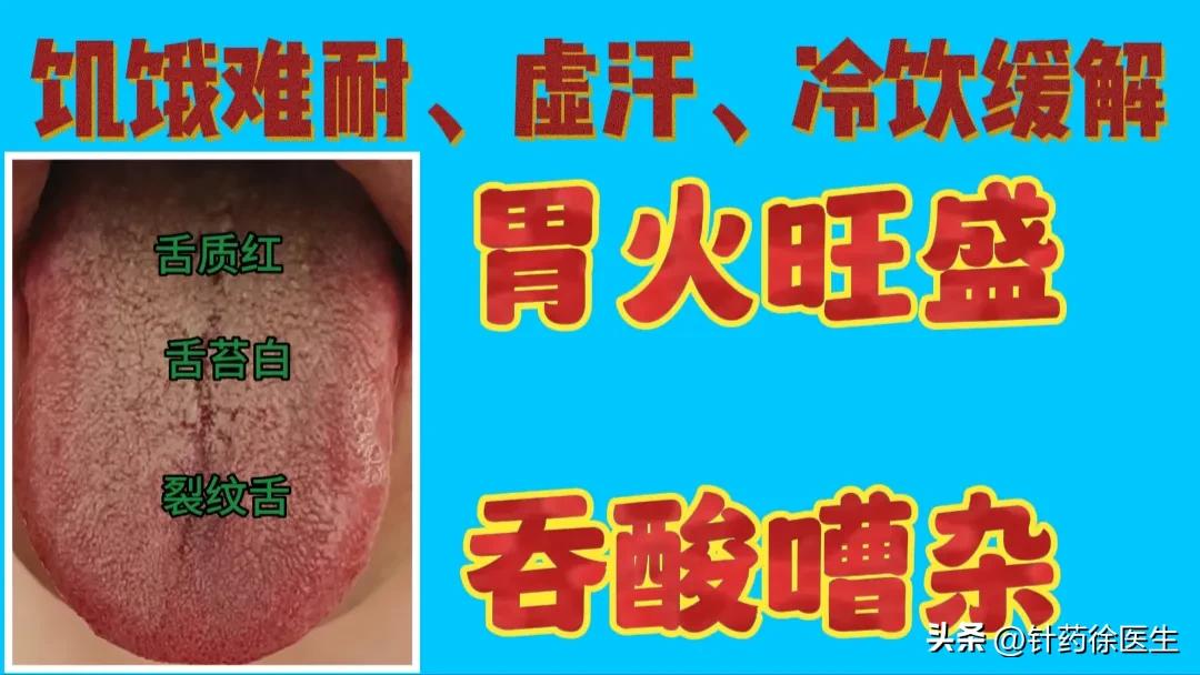 Uncle regularly hunger, sweating tongue phenomenon and medication - iNEWS