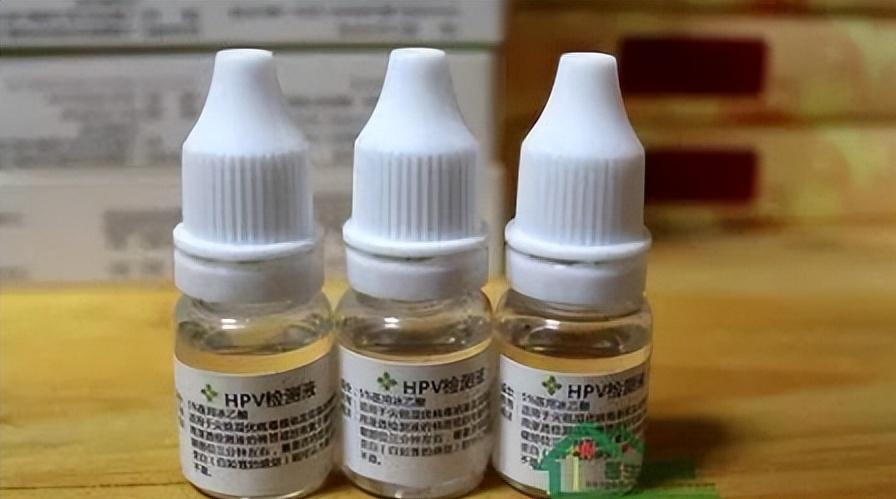 Suspected to be infected with genital warts, can white vinegar be used ...