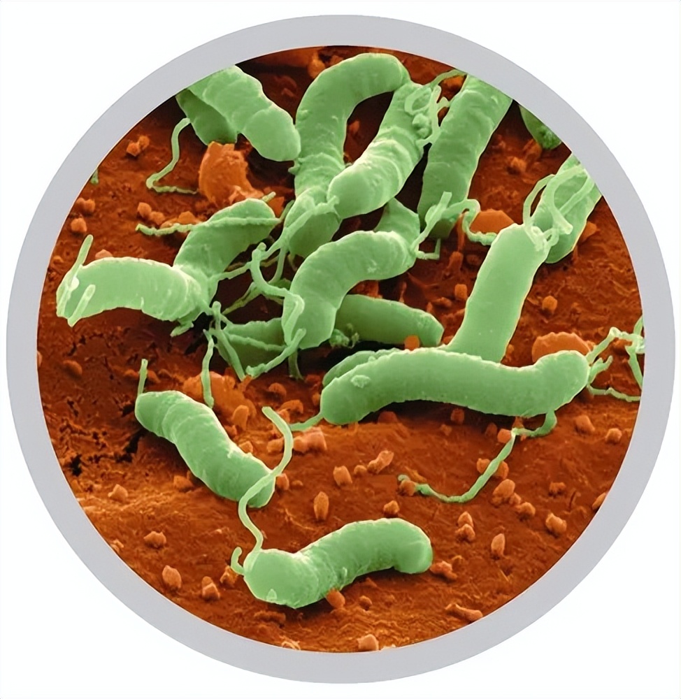 The importance of curiosity from the discovery of Helicobacter pylori ...