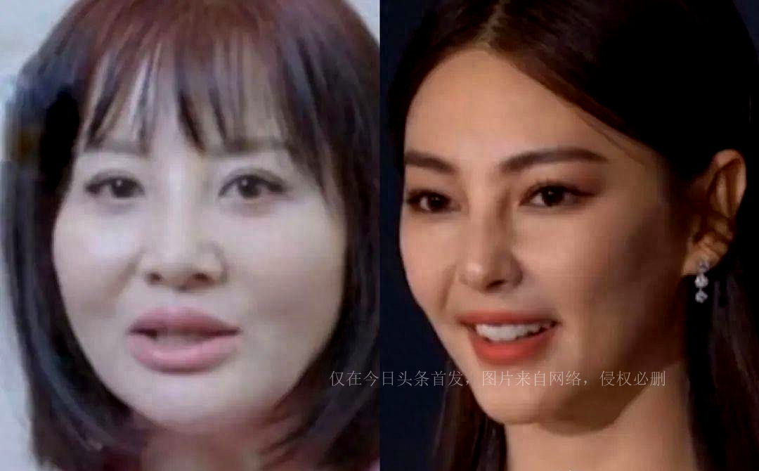 What's it like for a celebrity who hasn't recovered from having his ...