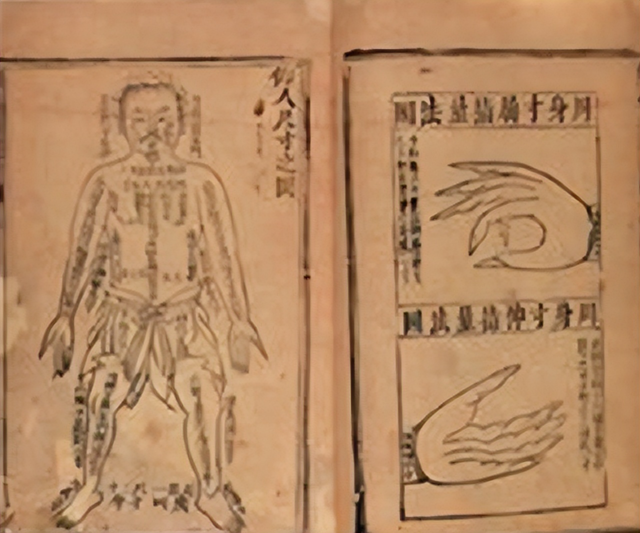 Discussion on the concept of disease in bamboo slips and silk medical ...