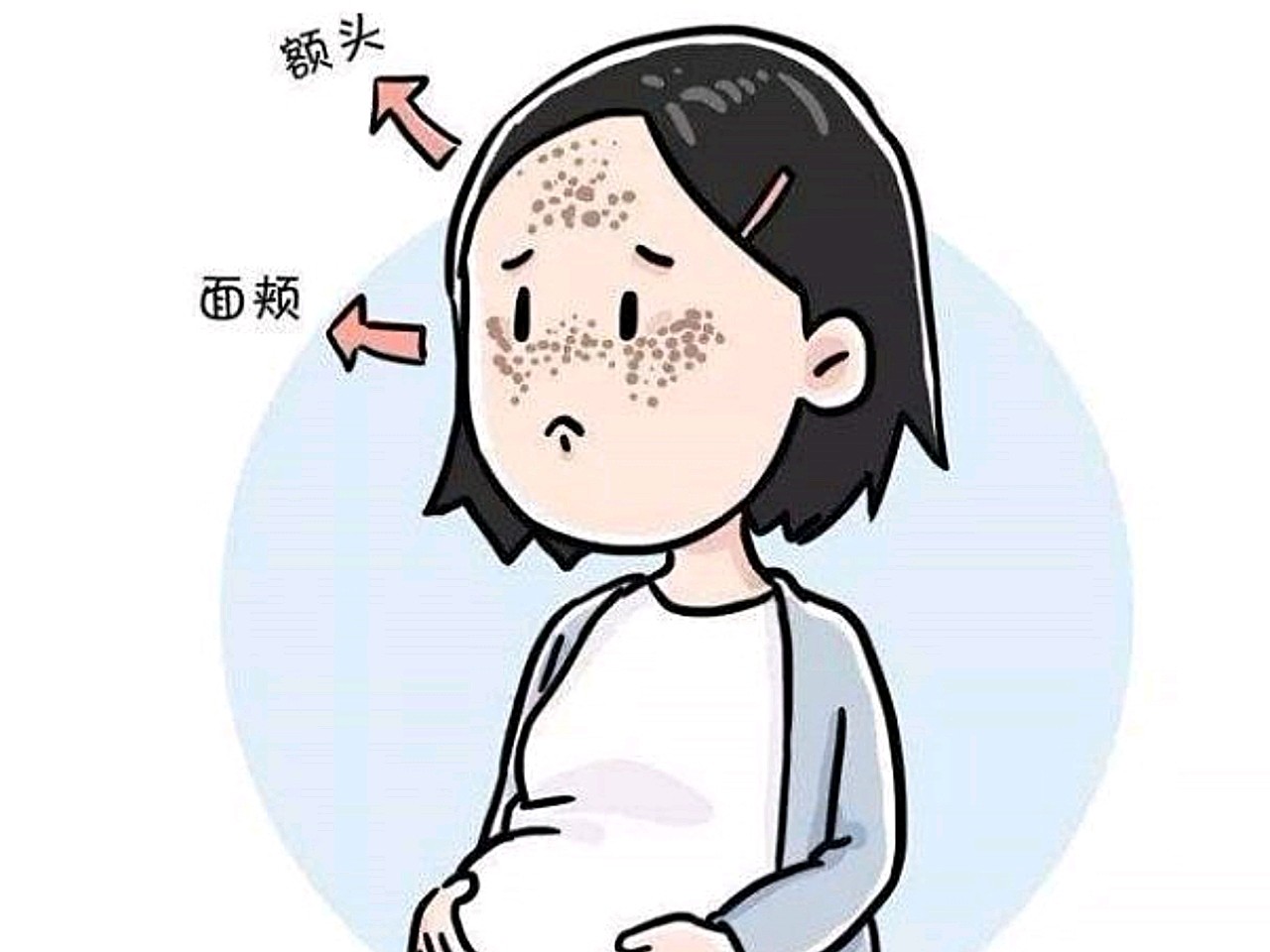 Take you to understand, what is chloasma - iMedia