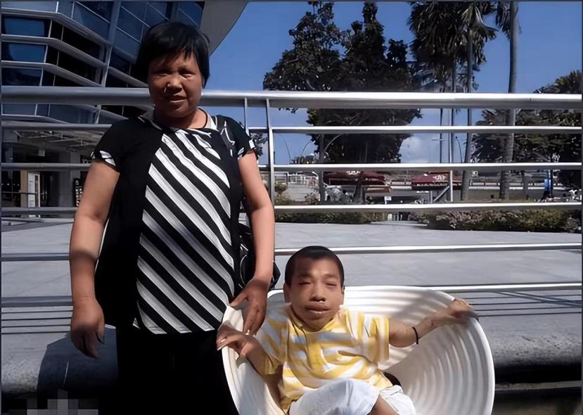 90cm "Mini President": Sitting in a wheelchair at the age of 29, he ...