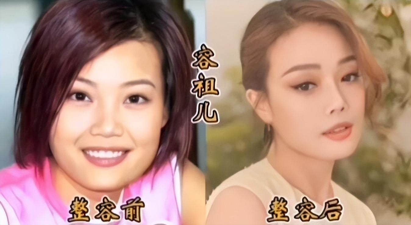 Comparing actresses before and after plastic surgery, Li Bingbing and ...