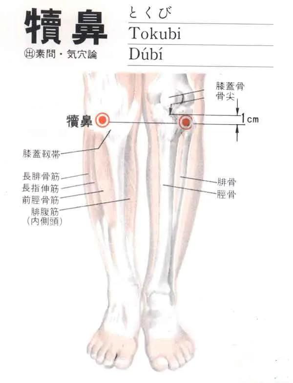 Dubi acupoint, which was forbidden to be pierced in ancient times, is ...