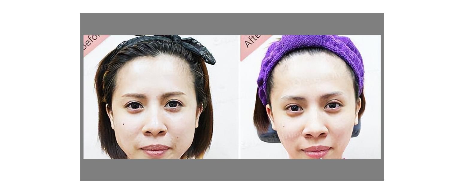 Plastic surgery - bone grinding these hazards you know - iNEWS