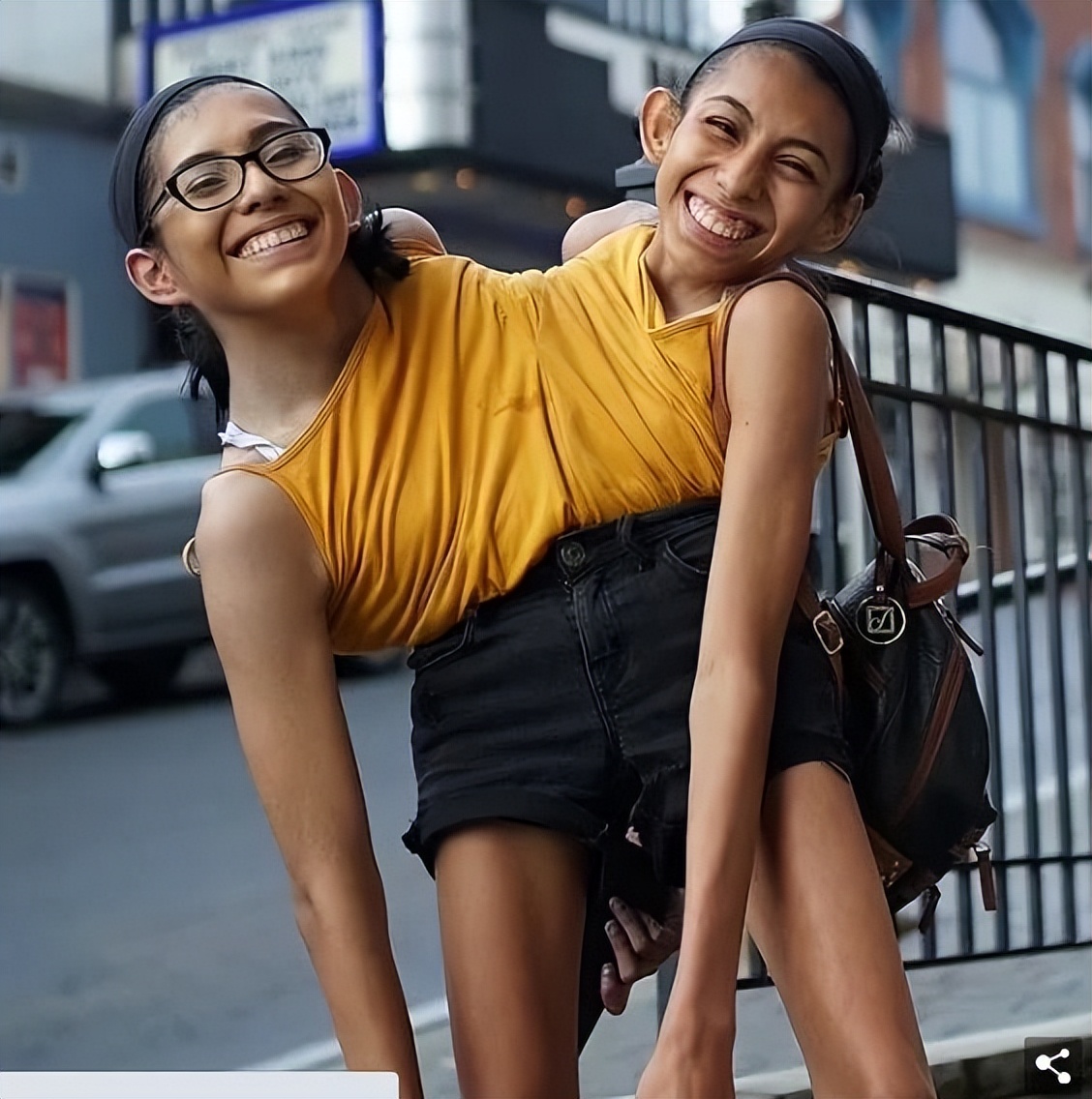 The conjoined twins have been in love with their boyfriend for more ...