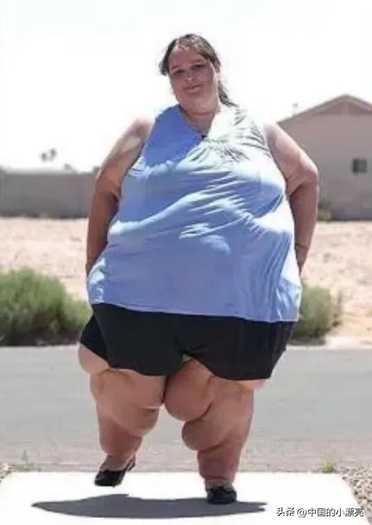 Do you know the fattest person in the world?come and see - iNEWS