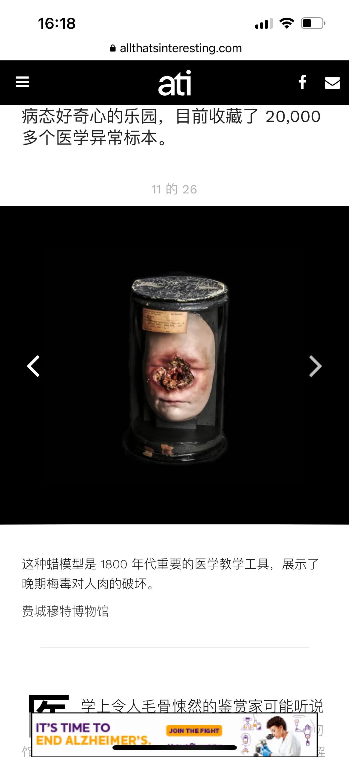 What You Didn't Know About Medical Abnormal Specimens on Display at the ...