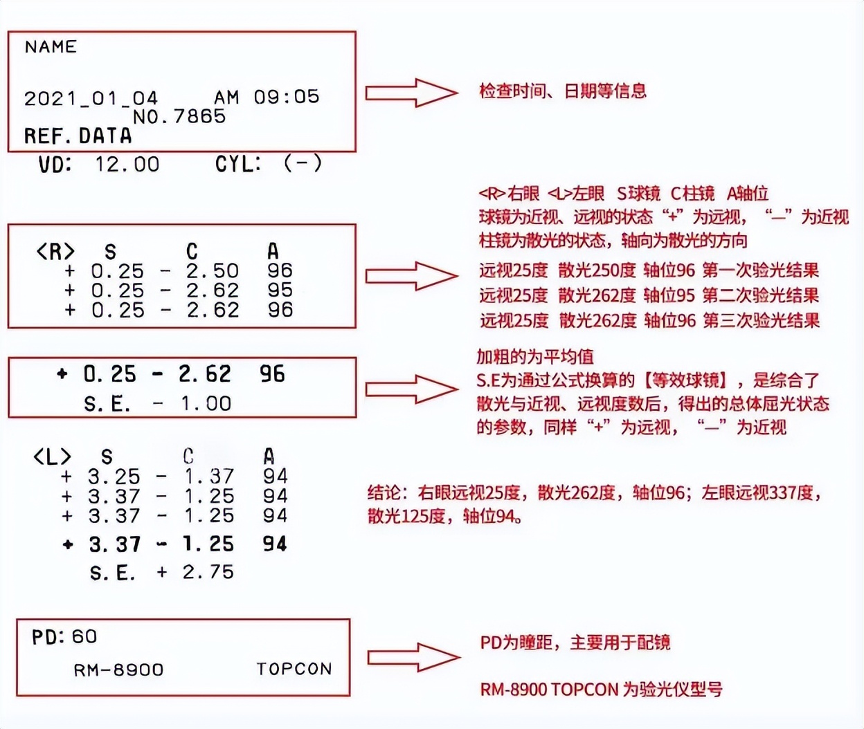 It only takes 1 minute to decode the computer optometry list - iNEWS