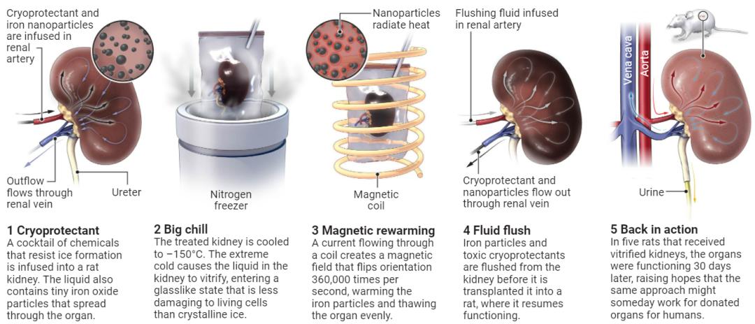 Freeze time! Major progress in organ transplantation, 100-day frozen ...