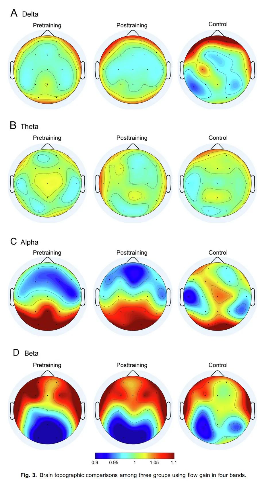 Clinical efficacy analysis of EEG biofeedback therapy for attention ...