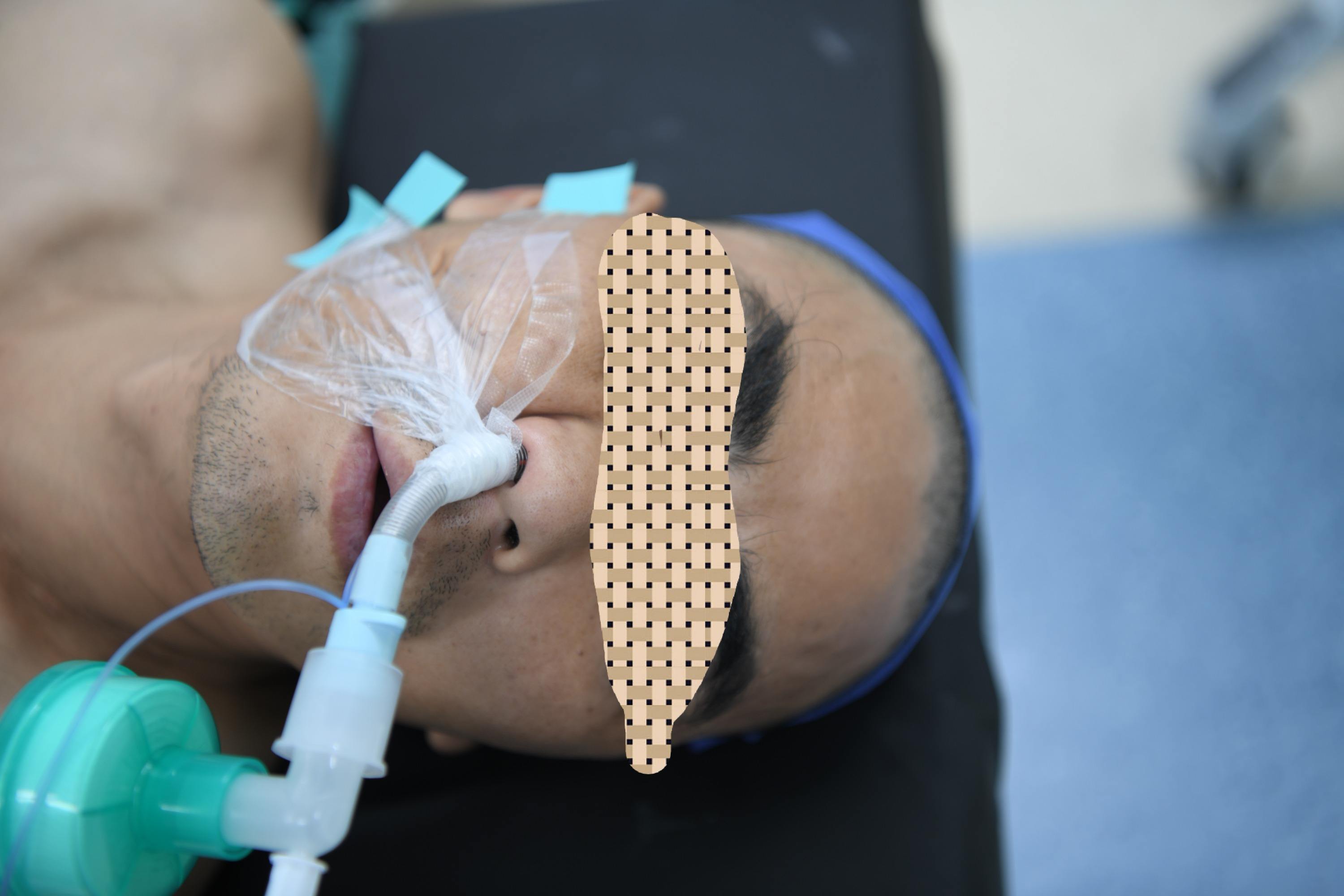The surgery to cut off the jaw and break the leg reminds everyone not ...