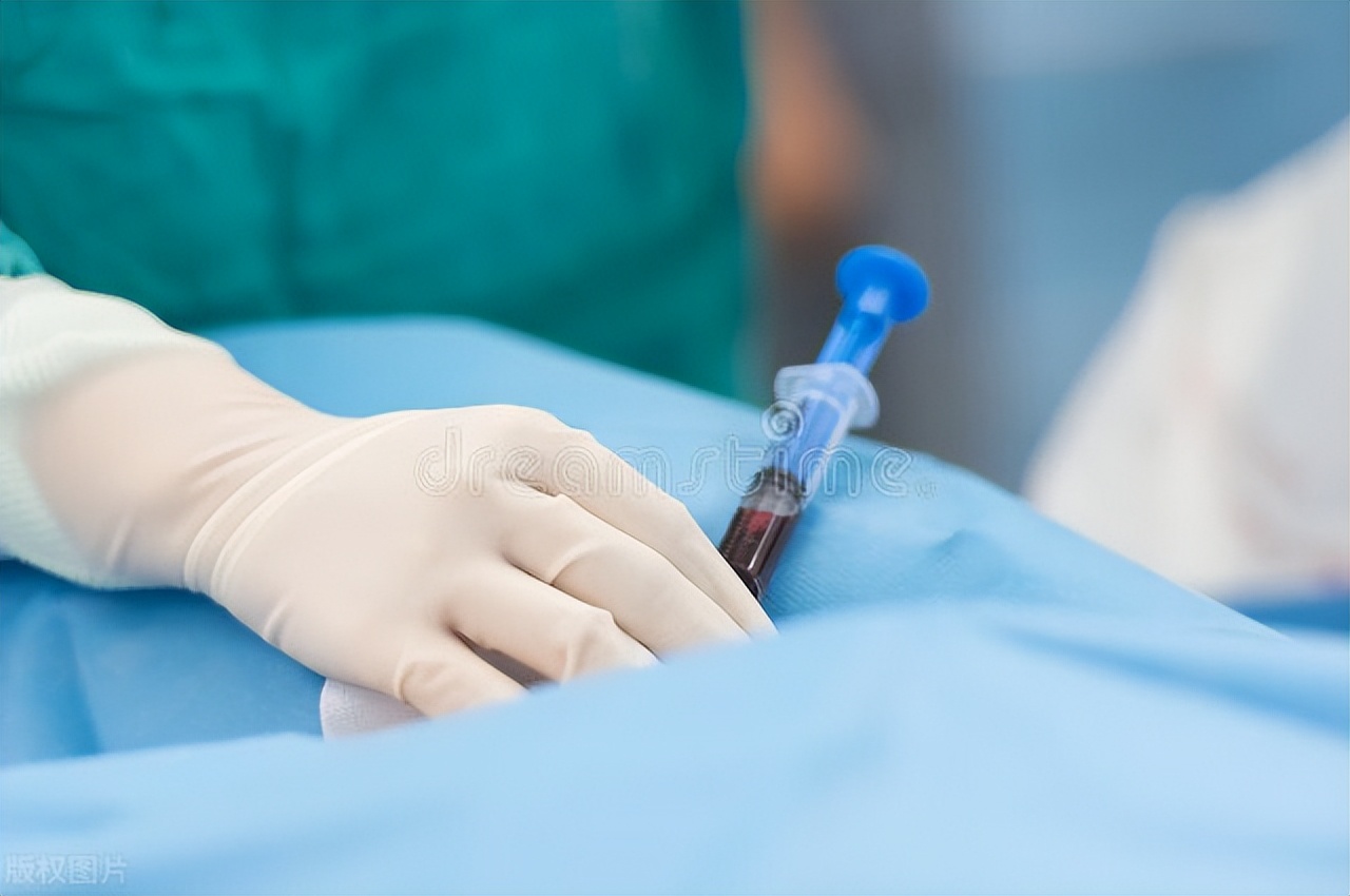 The patient's blood clotted so quickly that the doctor had to skip ...