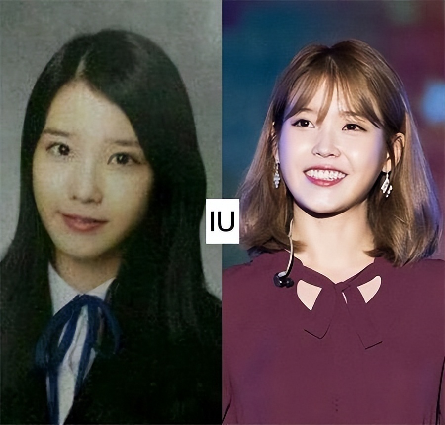 Su Wang's plastic surgery - also flat nose, iu can make the sky ...