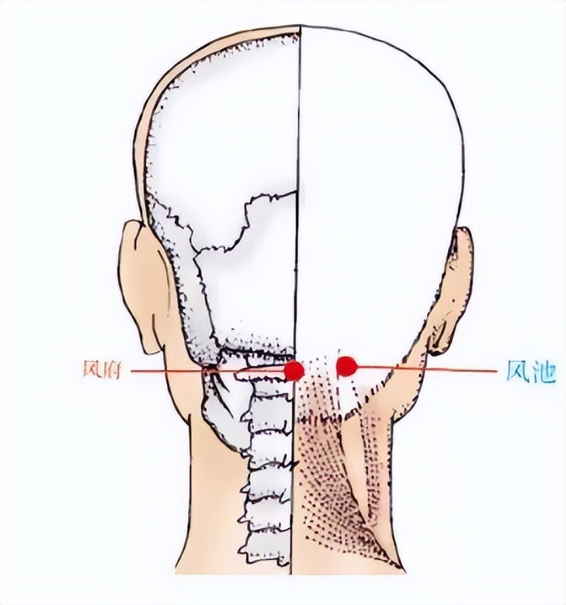 Headache special effect point selection - iMedia