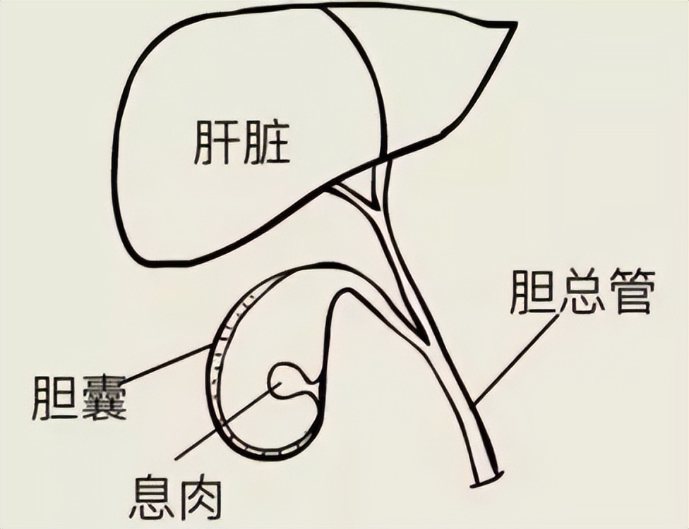 Why do gallbladder polyps cause back pain? - iNEWS