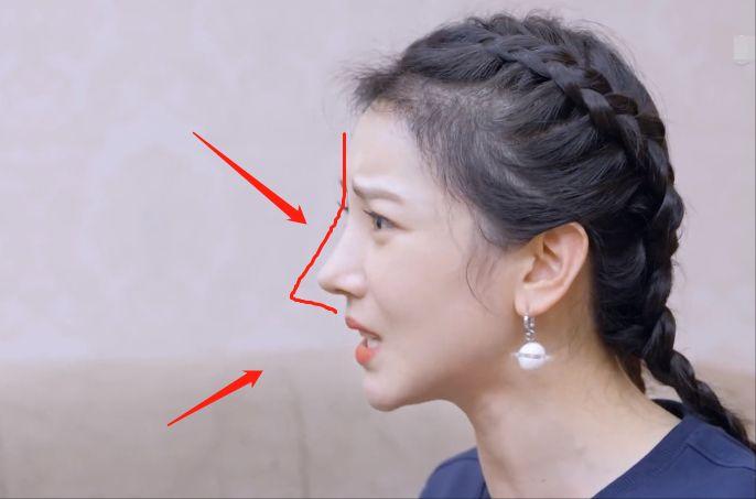 3 actresses with "pointy nostrils" feel unable to breathe through the ...