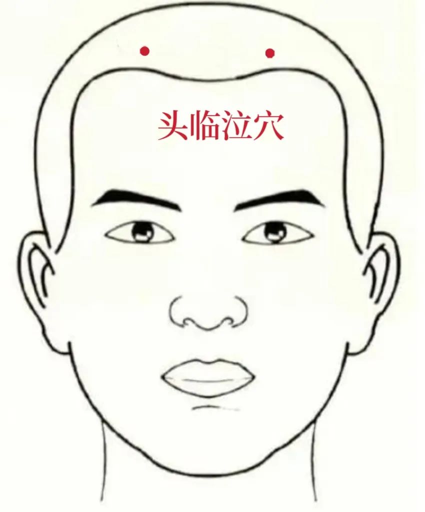 What to do with the wind and tears? Use these 5 "switches" well, and ...