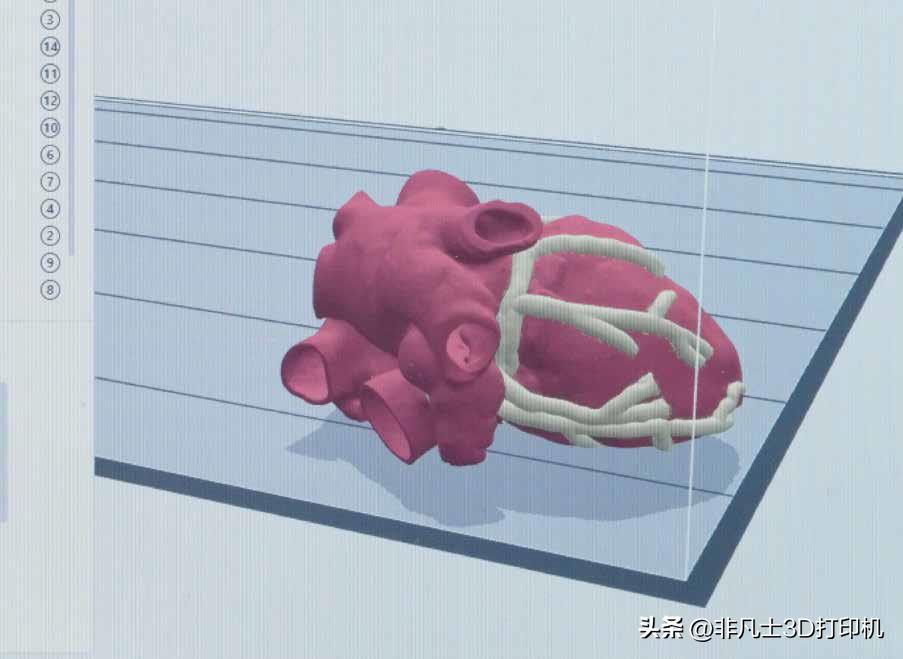 Xijing Hospital uses J850 to reduce the risk of heart surgery - iNEWS