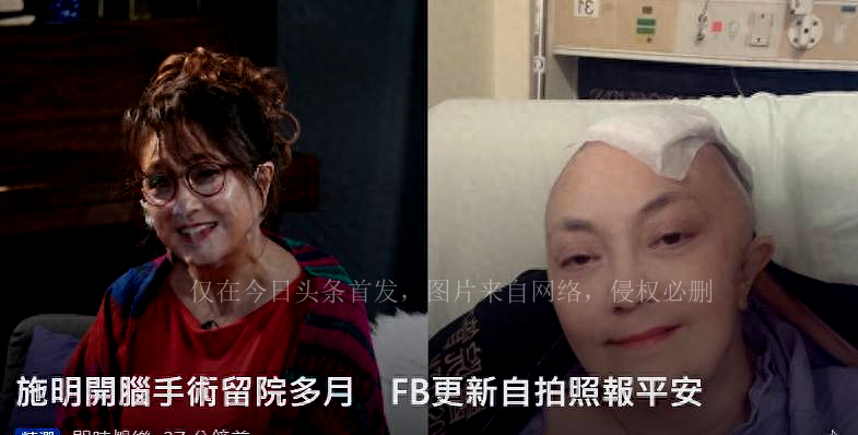 Veteran actor Shi Ming was in a severe coma and appeared for the first ...