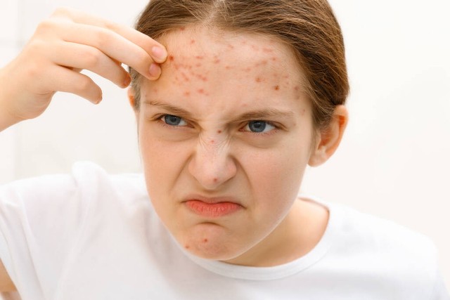 There are always pimples and pustules on the scalp, which may be the ...