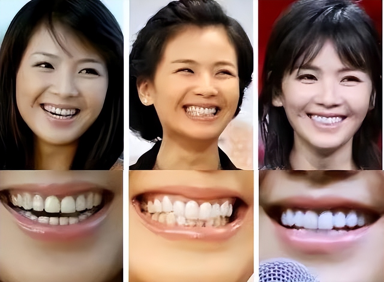 Star "porcelain teeth" are too fake!The reflection under the lens, the ...