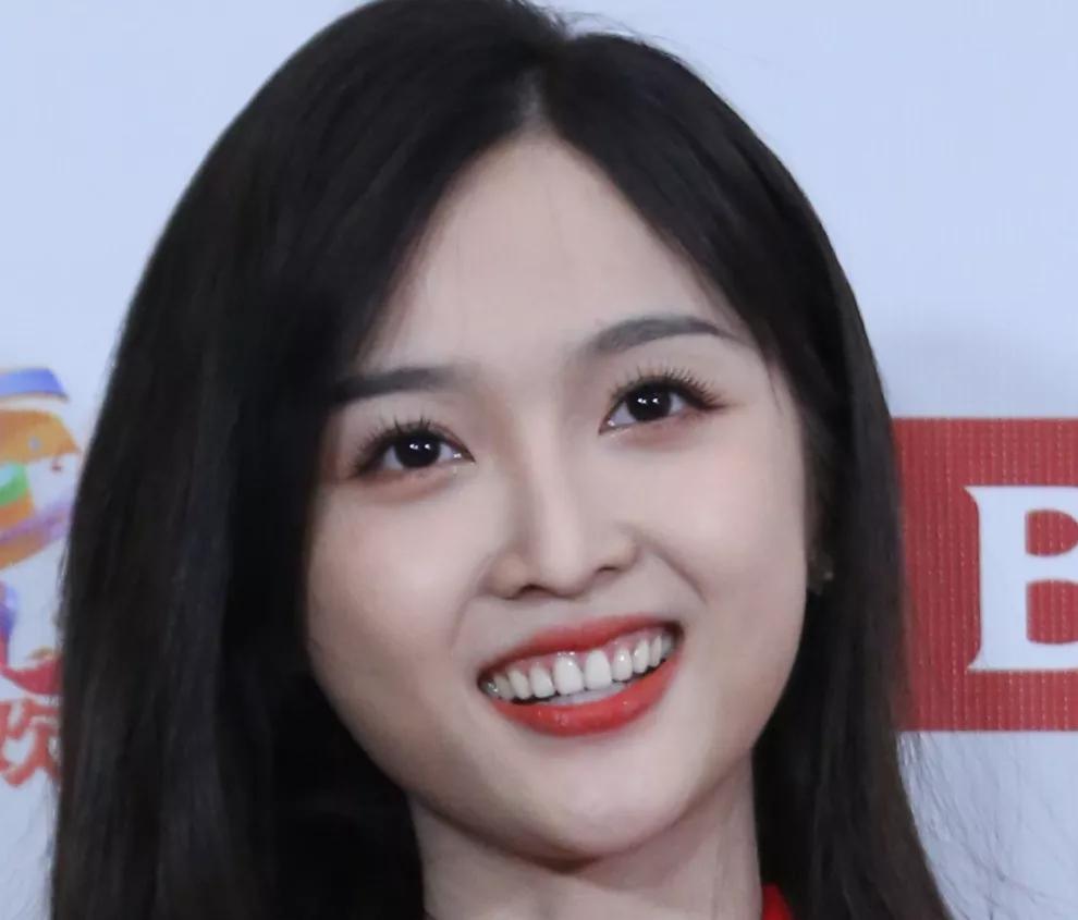 Hairy cheeks, swollen face, and a rugged face. Before the age of 30 ...