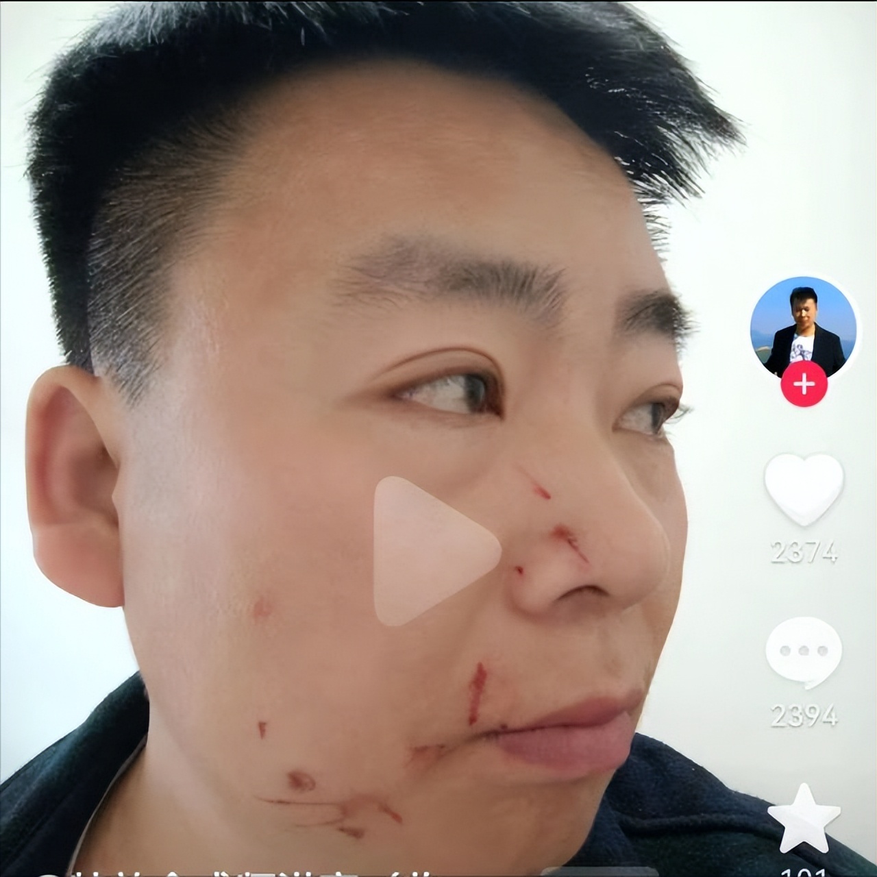 A video of a male internet celebrity's vulgar and fun composite kissing ...