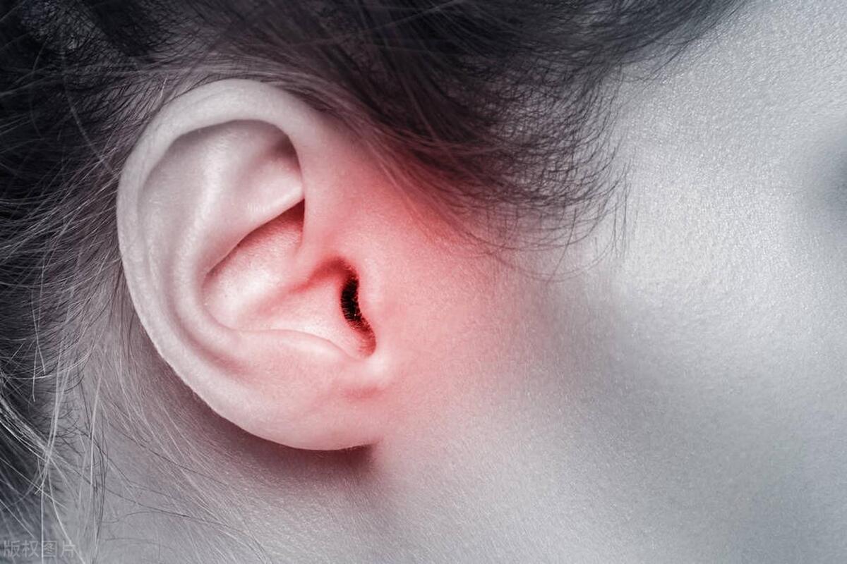 Coptis chinensis tablets worth a few dollars can not only clear away ...