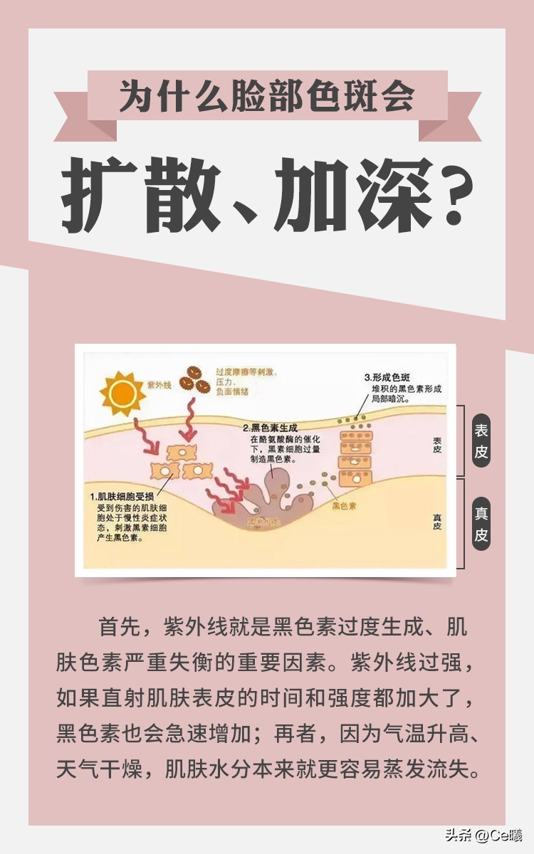 Why do the spots on the face spread and deepen?What is the cause of ...