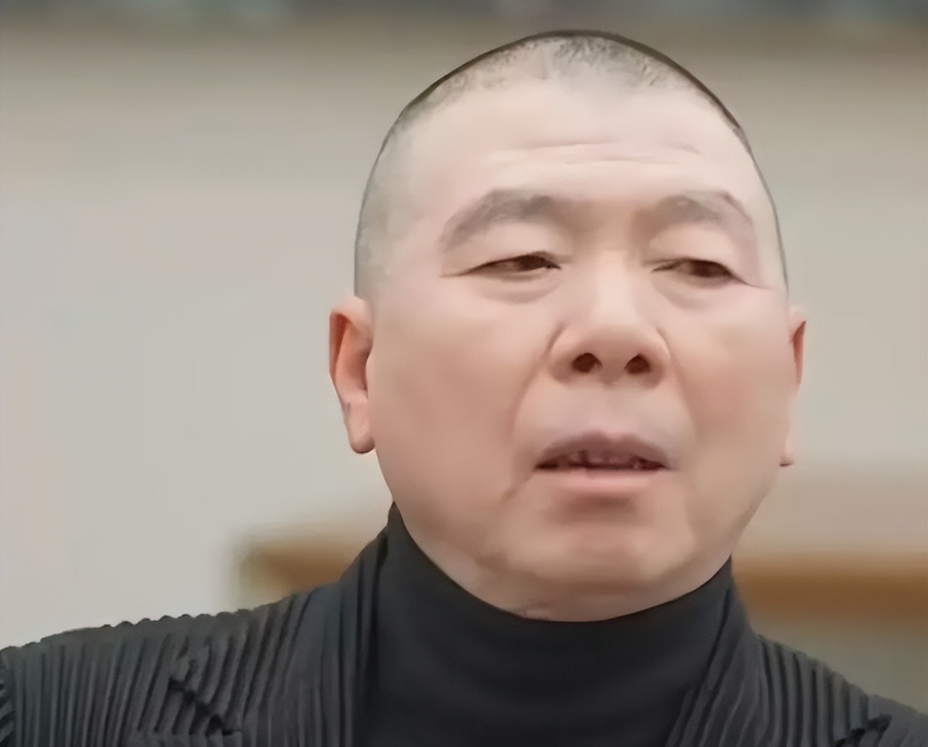 Feng Xiaogang's vitiligo symptoms disappeared for many years! His bald ...