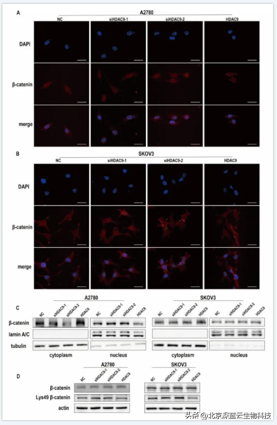 Application of Echo Revolve Microscopy in Epithelial Ovarian Cancer ...