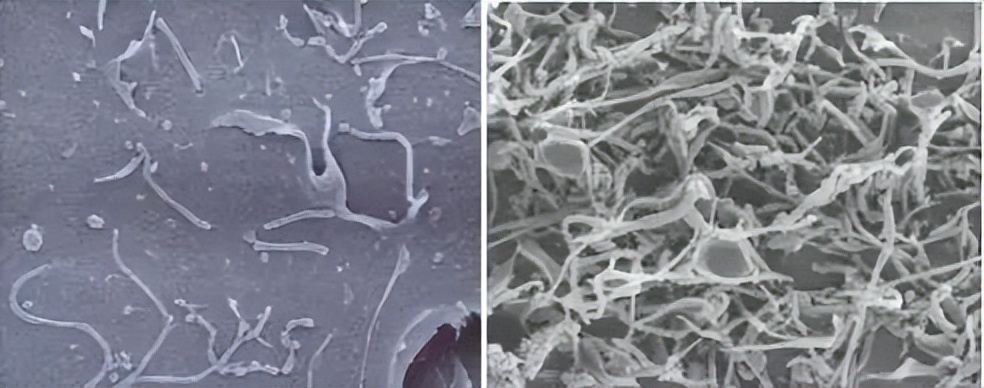 How will mycoplasma contamination affect our experiments?How to deal ...