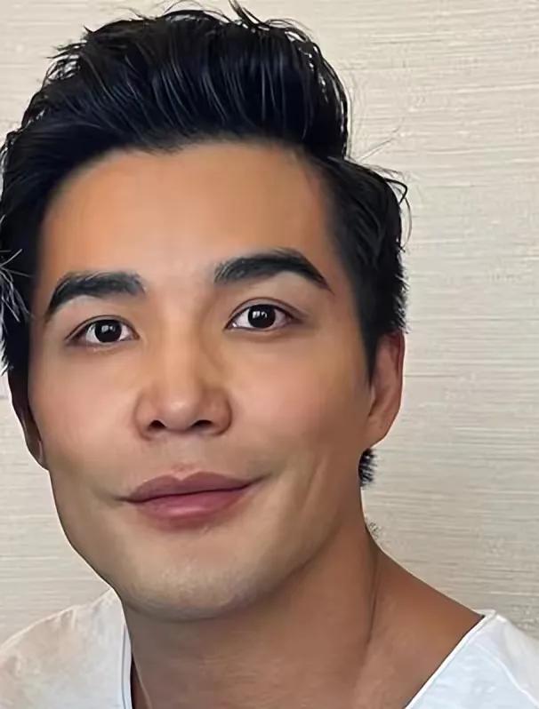 Actor Lin Ludi's face has changed, and he is suspected of having ...